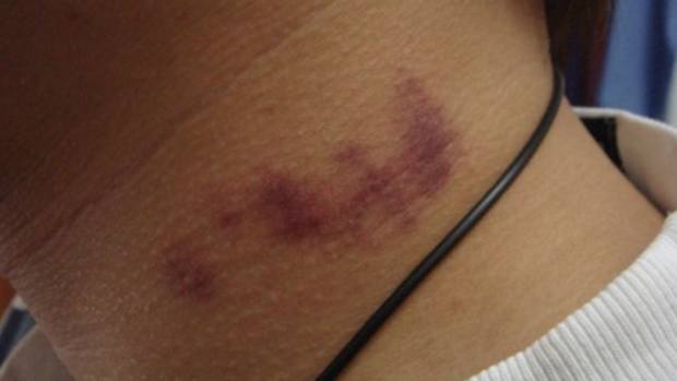 Bizar: zijn vriendin gaf hem een zuigzoen, wat er toen gebeurde ga je ...