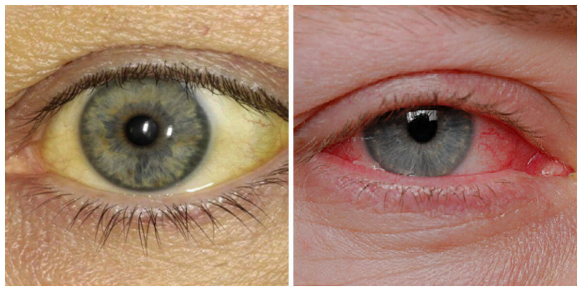 Je ogen verklappen ontzettend veel over je algemene gezondheid! DIT ...